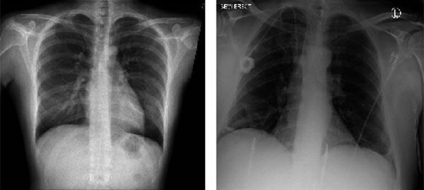 News | intelligent imaging